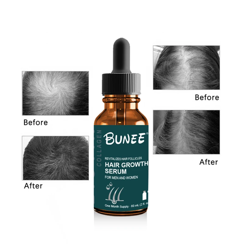 Bunee Thinning Hair Loss Treatment Liquid Solution Serum 60ml regrowth ...